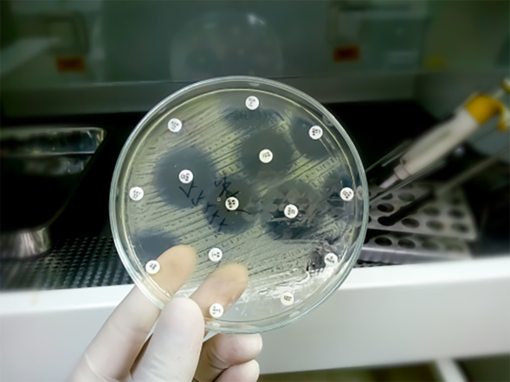 La prescripción diferida de antibióticos reduce costes y resulta ...