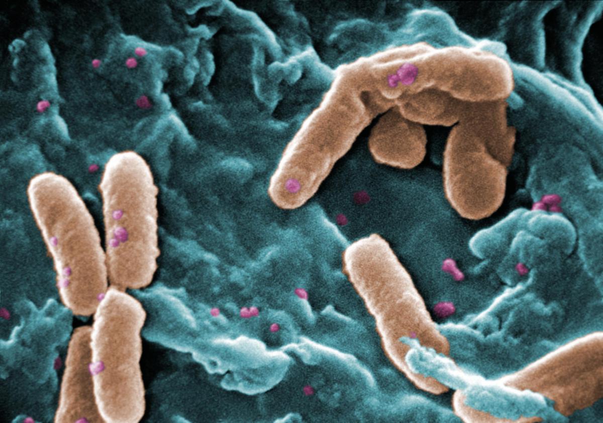 Infección bacteriana en pacientes con covid-19 | Cochrane Iberoamérica
